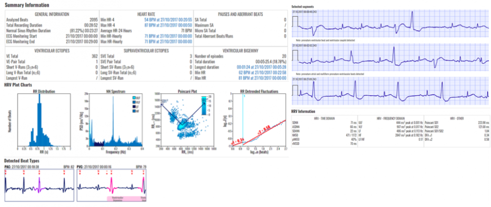 Mobile Cardiac Monitoring - MediBioSense